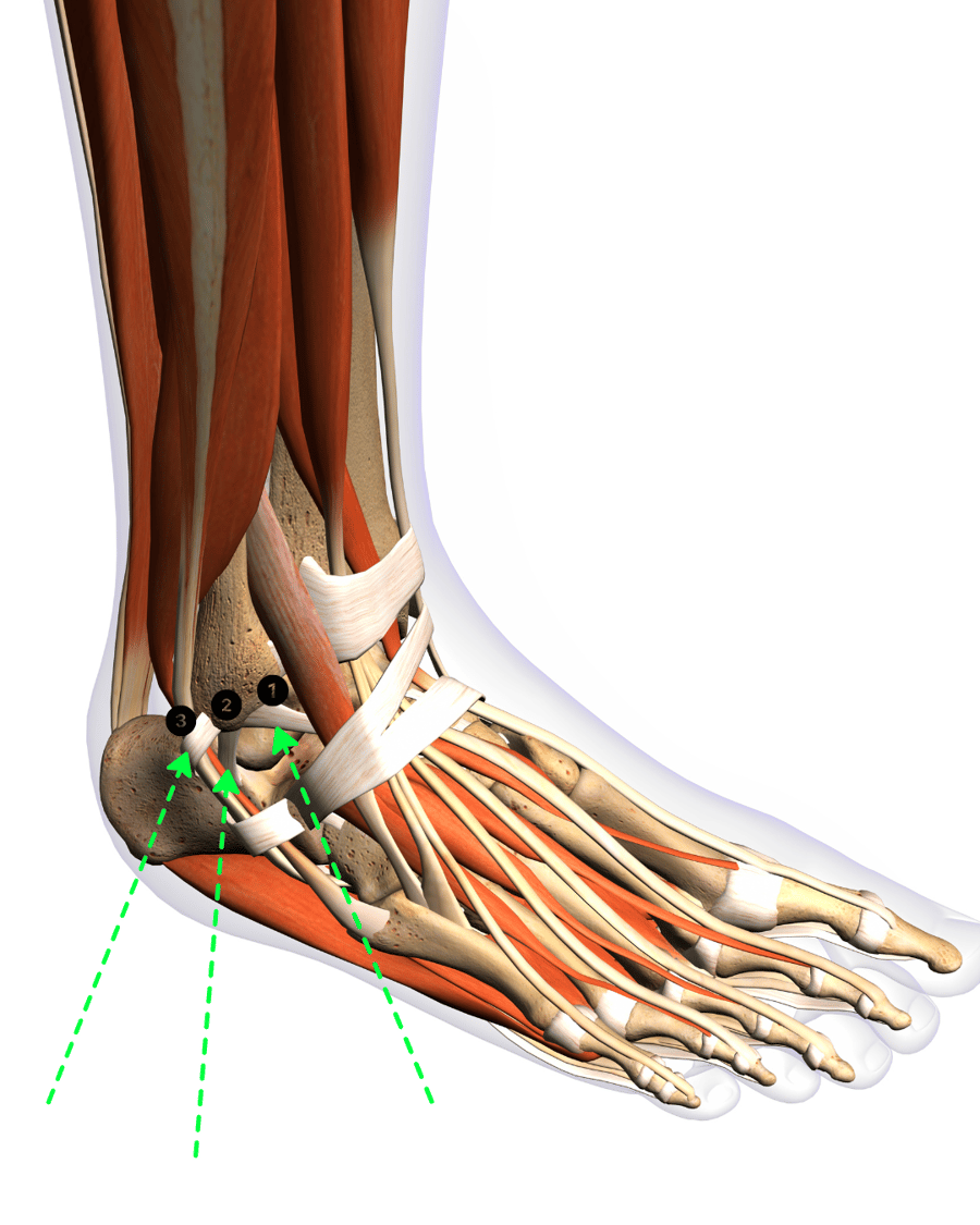 “I Just Rolled My Ankle!” – Ankle Sprains 101: Stay Strong, Heal Fast